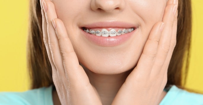 can braces fix asymmetrical face can braces fix asymmetrical face